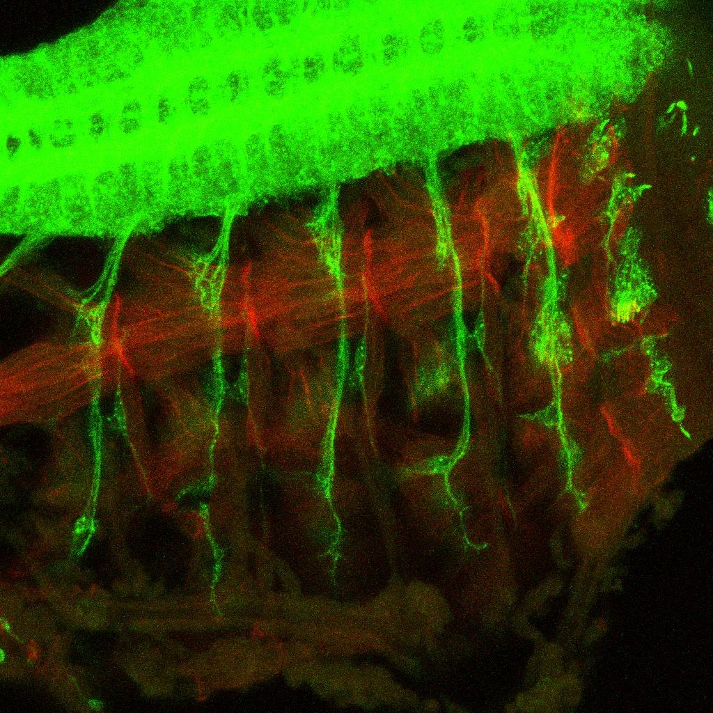 MAX_Ph_Tubulin_5_gfpactin – SLAM Lab